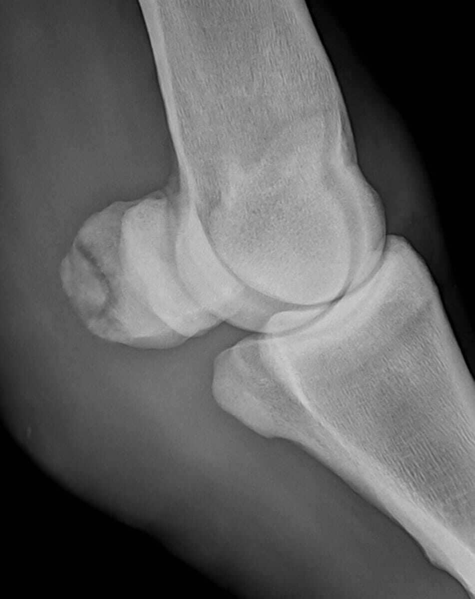 SESAMOIDS: LITTLE BONES, BIG ISSUES - Equestrian Life